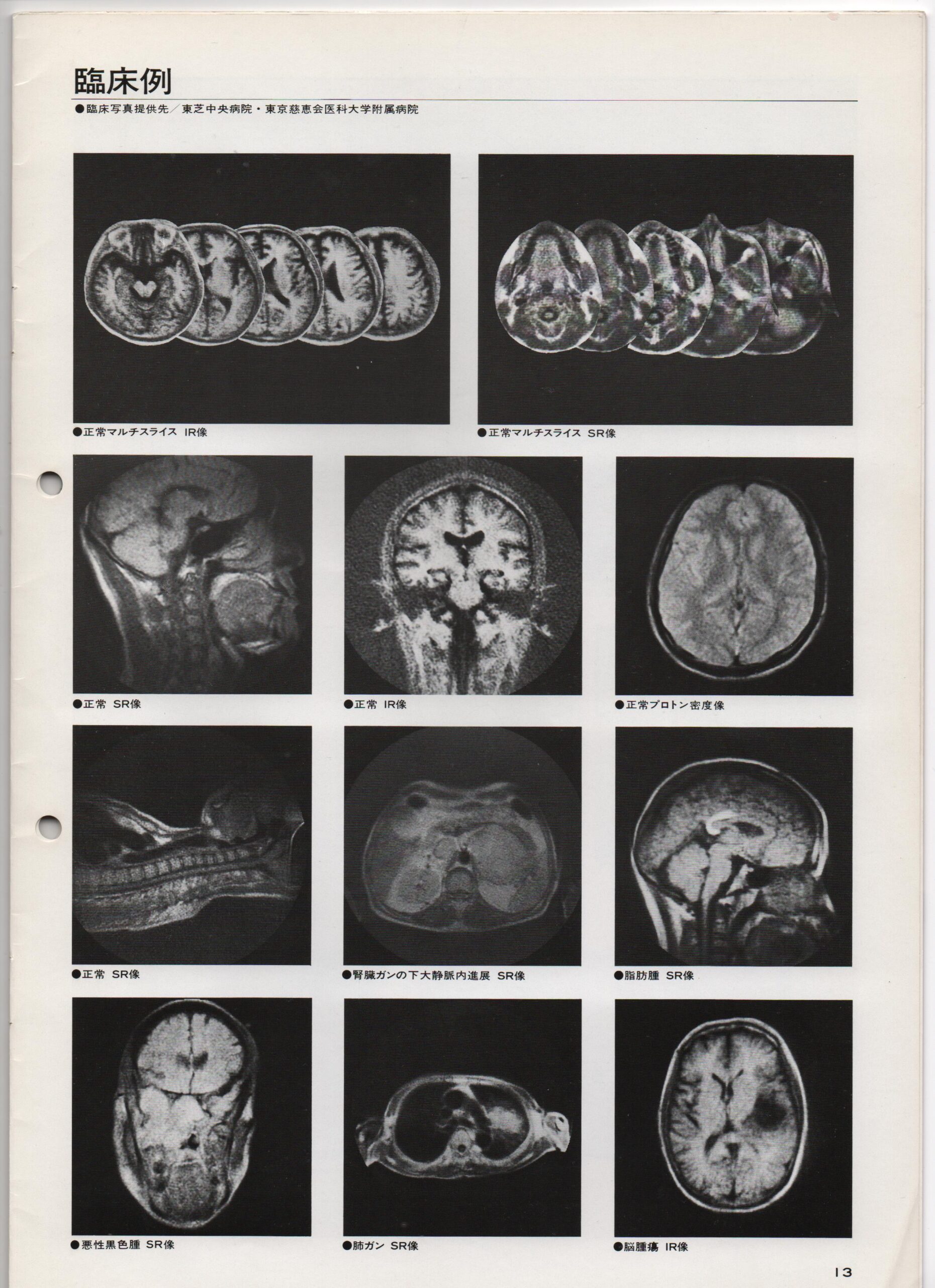 東芝MRT-15Aカタログ | Japan MRI history